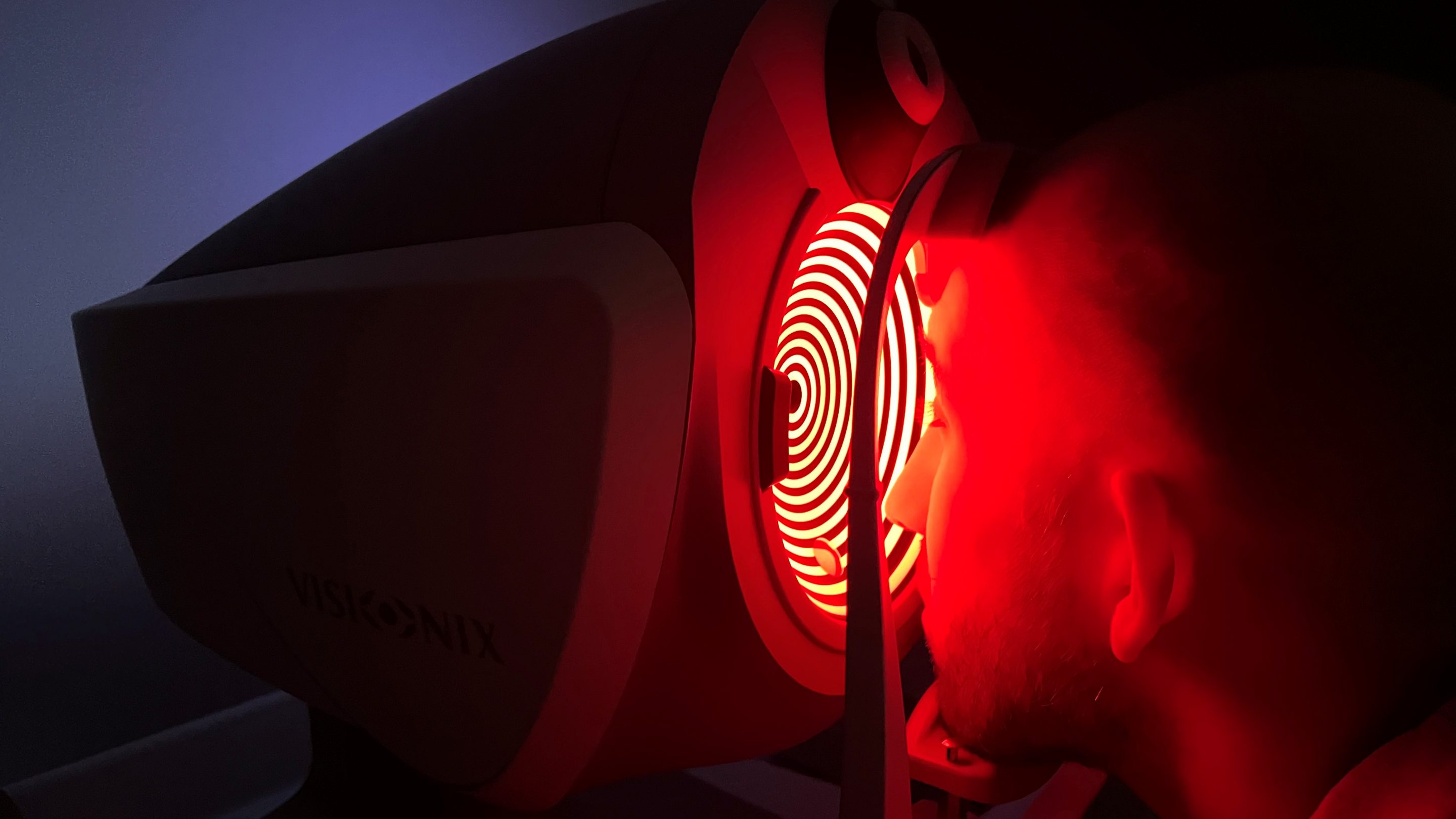 Vos questions et nos conseils • Laser Oculus